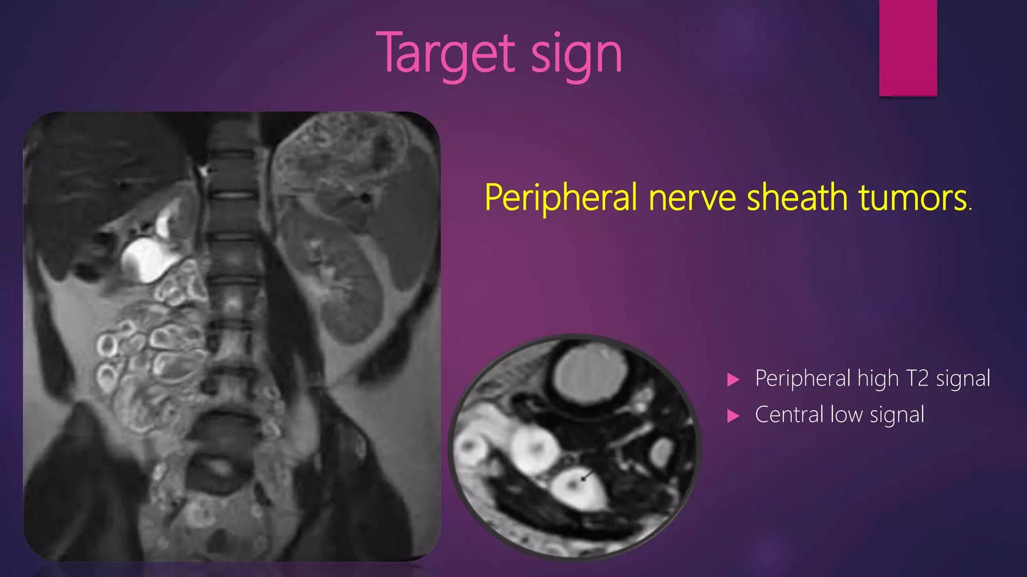 Msk signs edited | PPTX