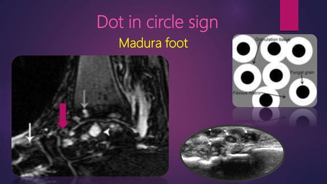 Msk signs edited | PPTX | Death, Injury, or Military Conflict ...