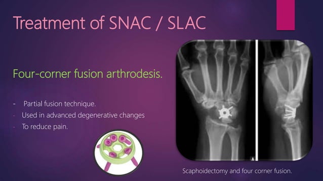 Msk signs edited | PPTX | Death, Injury, or Military Conflict ...