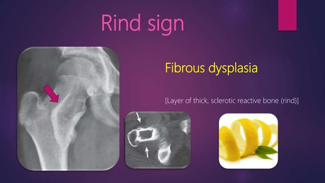 Msk signs edited | PPTX | Death, Injury, or Military Conflict ...