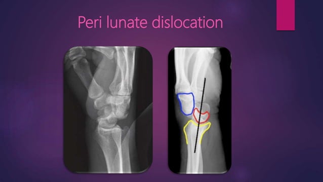 Msk signs edited | PPTX | Death, Injury, or Military Conflict ...