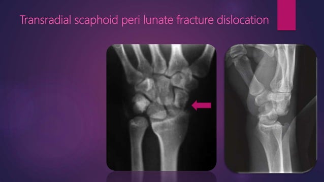 Msk signs edited | PPTX | Death, Injury, or Military Conflict ...
