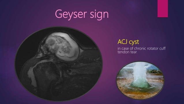 Msk signs edited | PPTX | Death, Injury, or Military Conflict ...