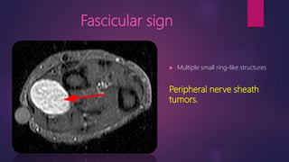 Msk signs edited | PPT