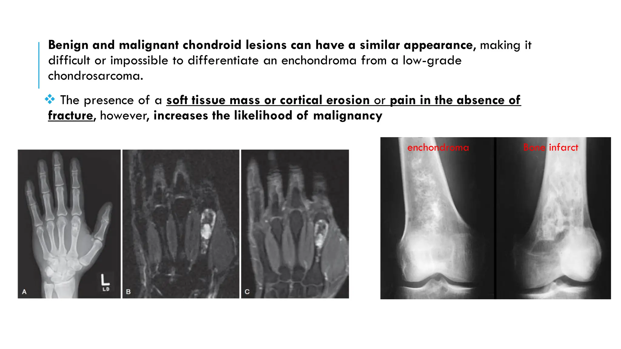 msk tumor.pdf