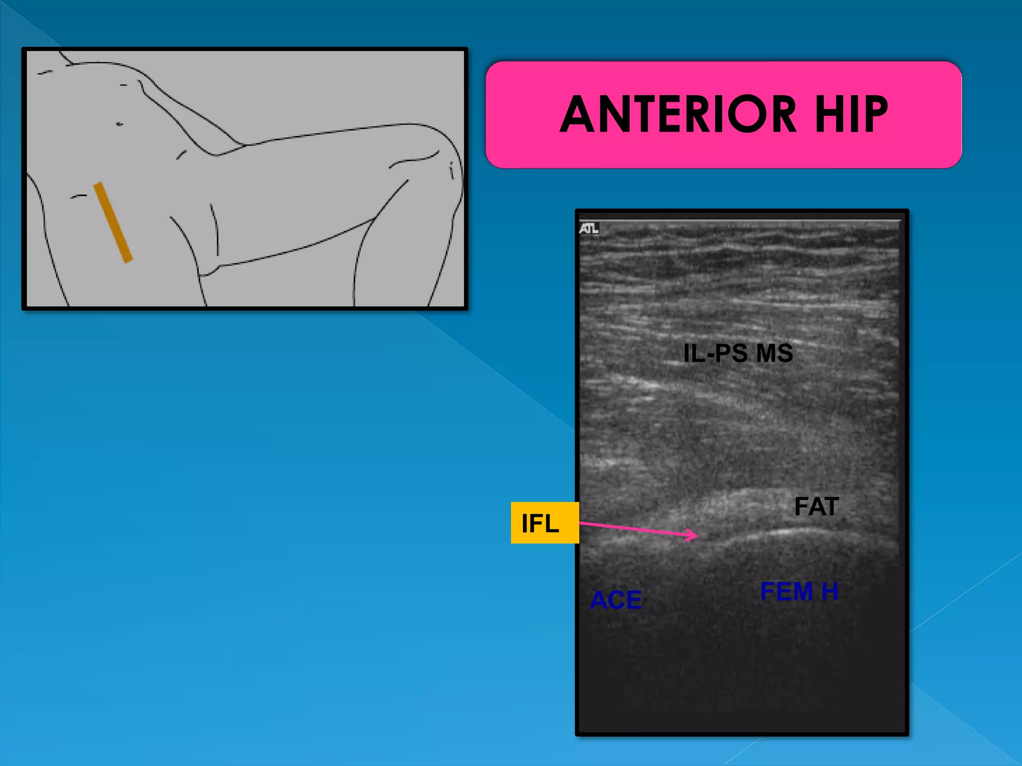 Msk US LL anatomy & technique pdf | PDF