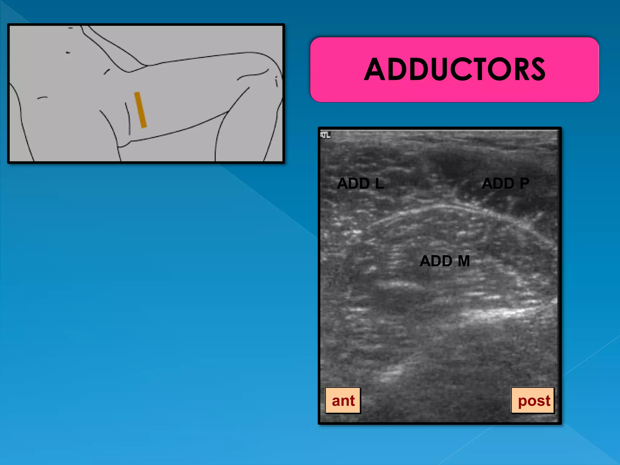 Msk US LL anatomy & technique pdf | PDF