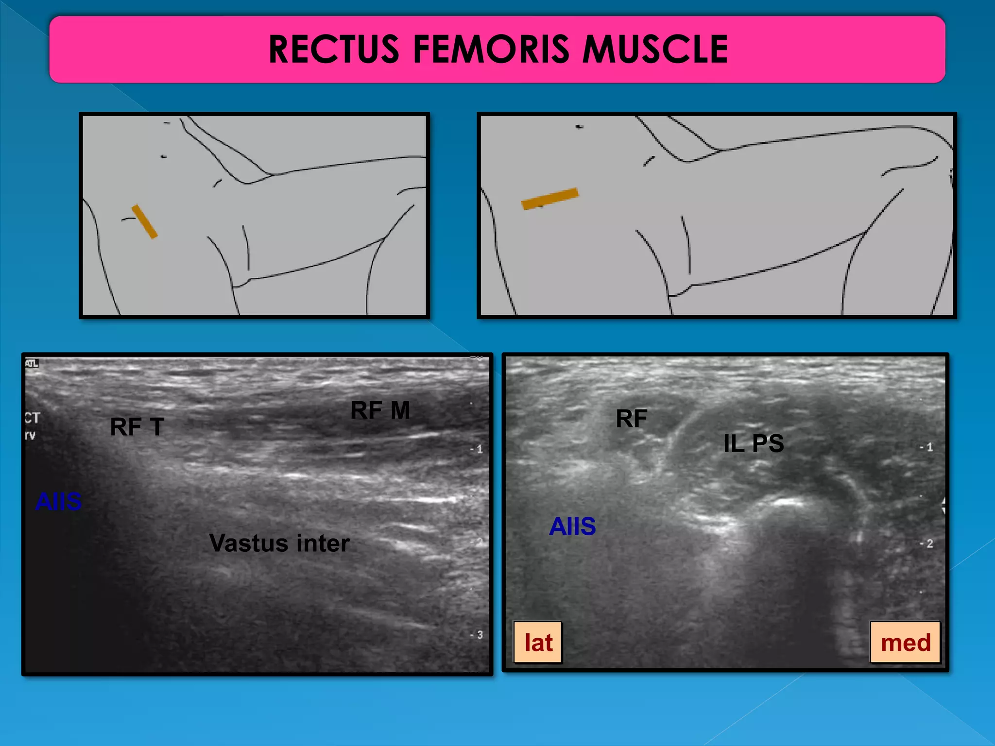 Msk US LL anatomy & technique pdf | PDF