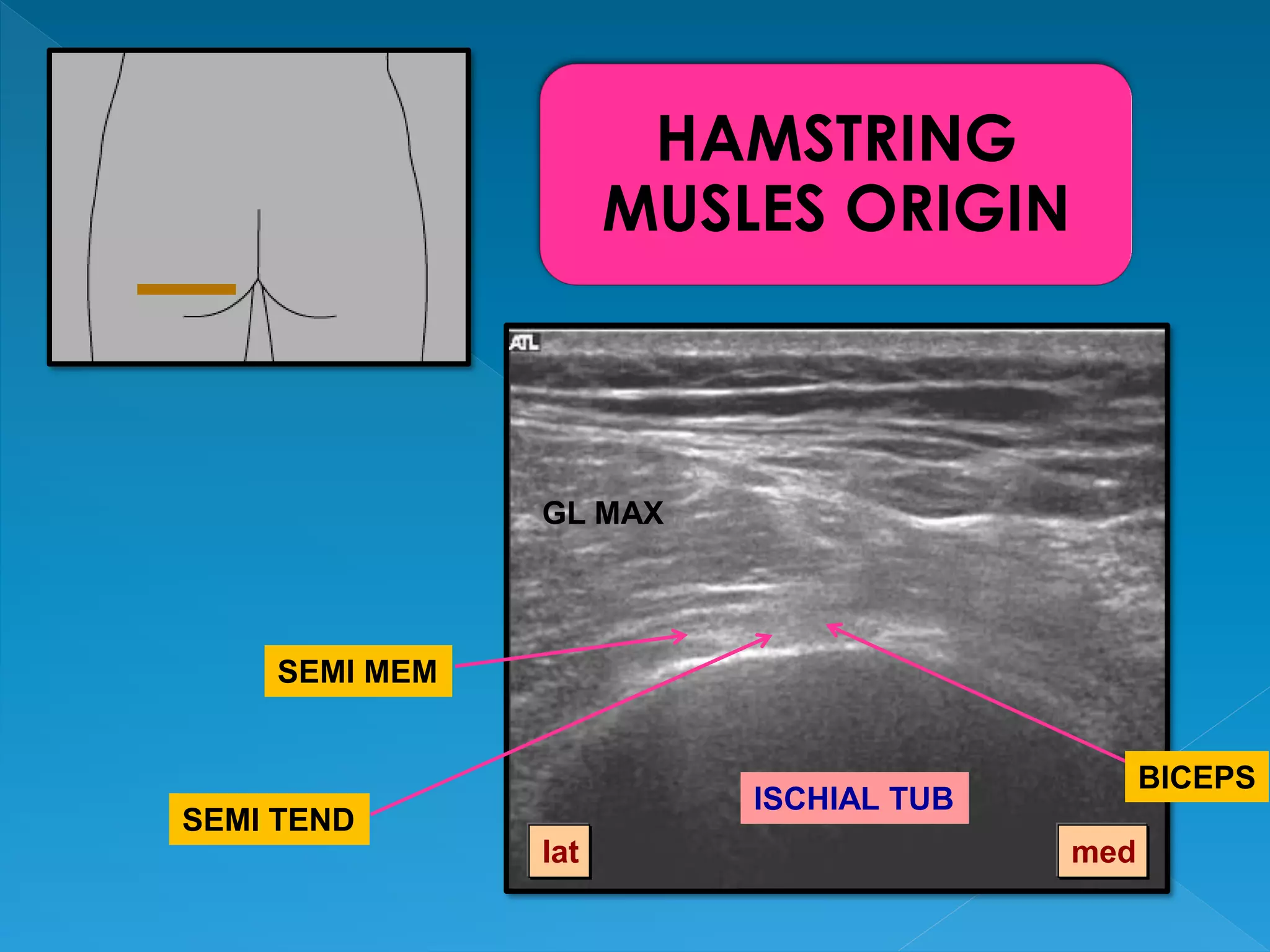 Msk US LL anatomy & technique pdf | PPT