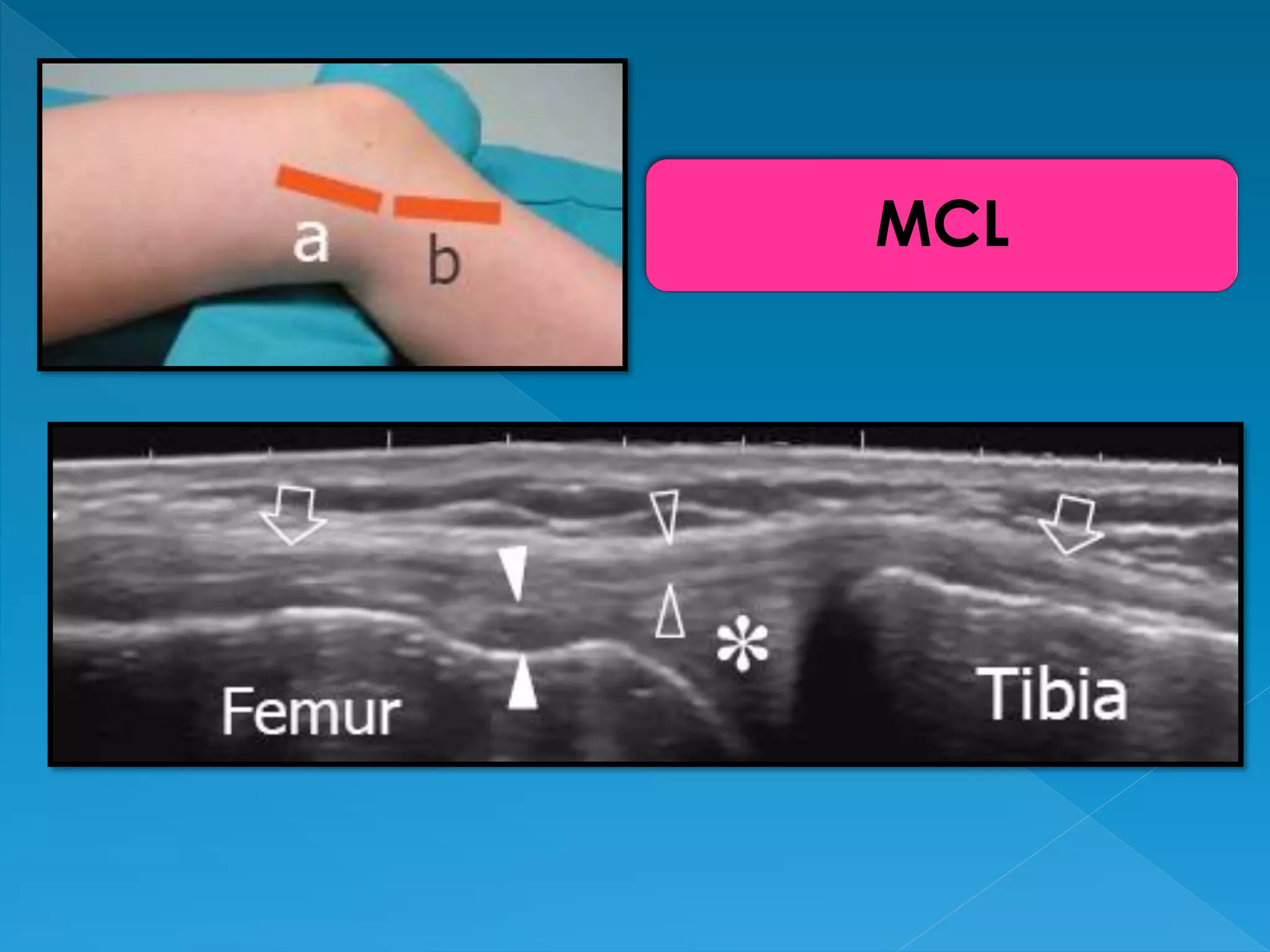 Msk US LL anatomy & technique pdf | PDF
