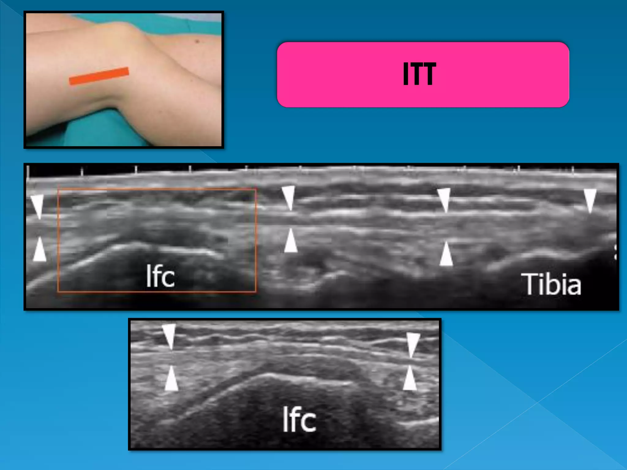 Msk US LL anatomy & technique pdf | PDF