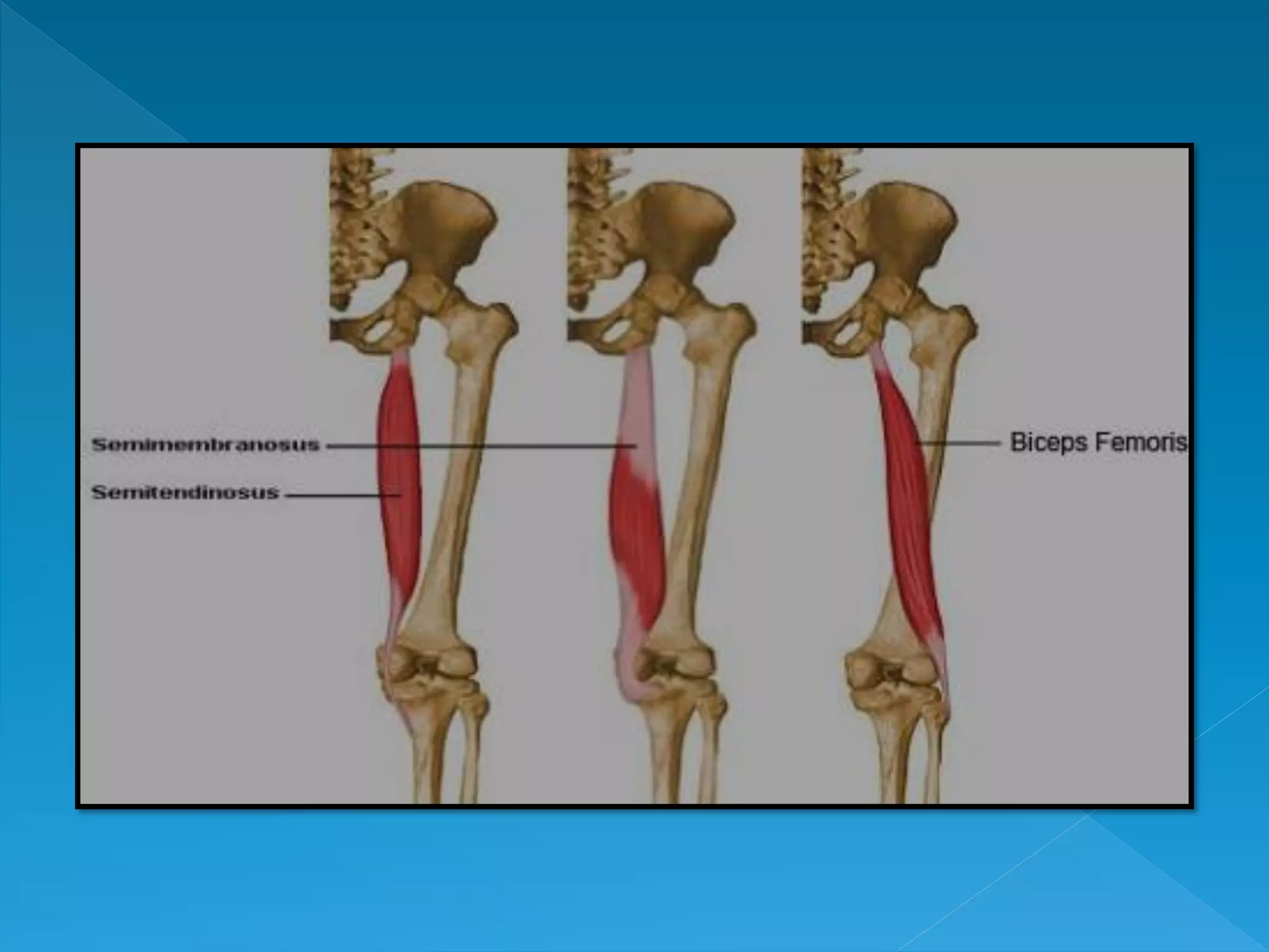 Msk US LL anatomy & technique pdf | PDF