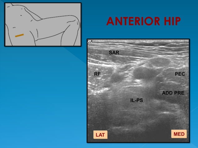 Msk US LL anatomy & technique pdf | PPT