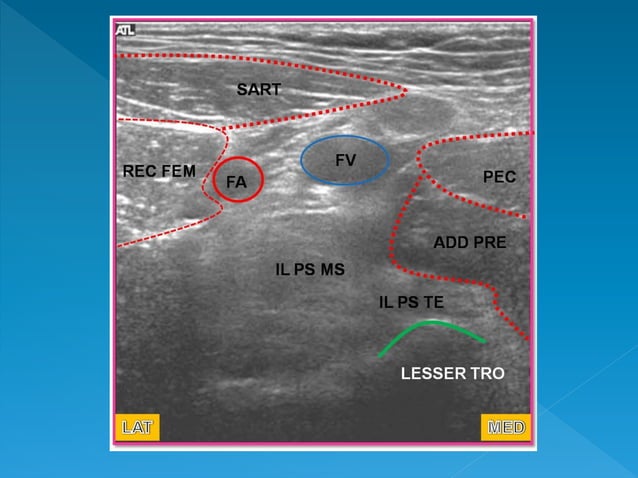 Msk US LL anatomy & technique pdf | PPT