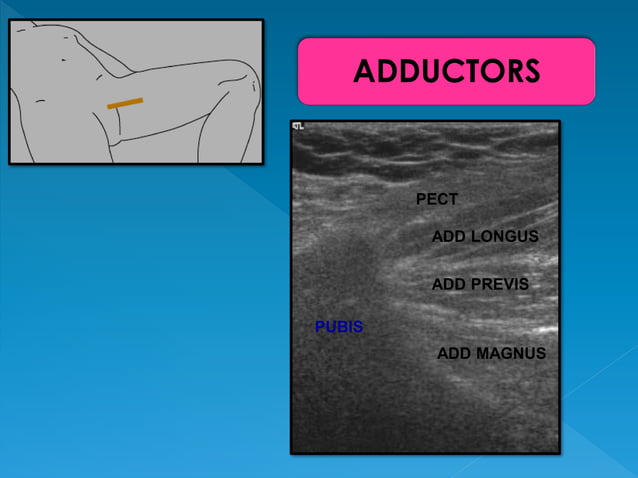 Msk US LL anatomy & technique pdf | PPT