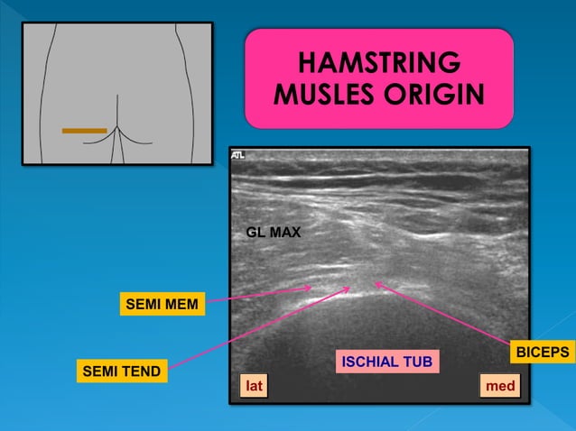 Msk US LL anatomy & technique pdf | PPT