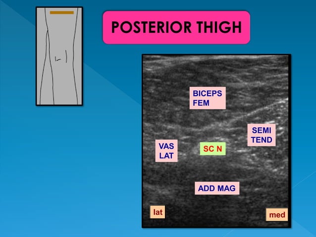 Msk US LL anatomy & technique pdf | PPT