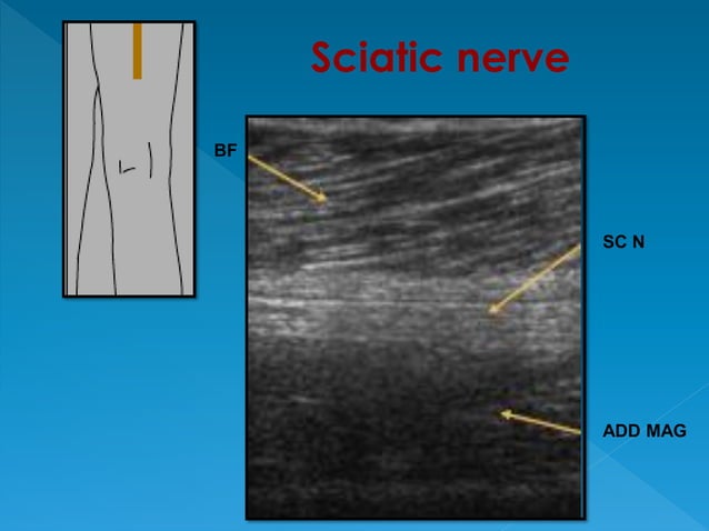 Msk US LL anatomy & technique pdf | PPT