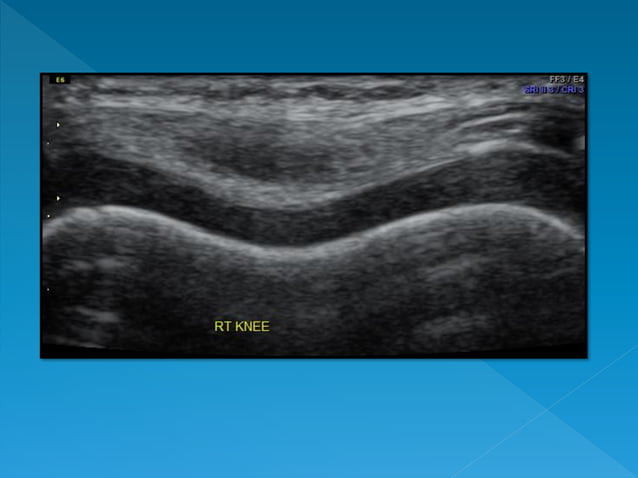 Msk US LL anatomy & technique pdf | PPT
