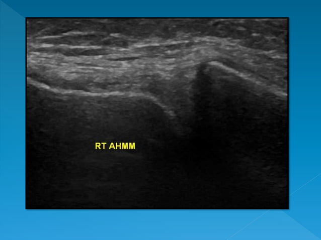 Msk US LL anatomy & technique pdf | PPT
