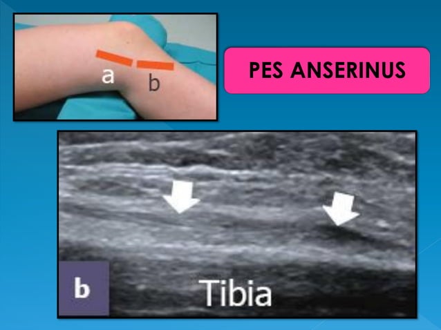 Msk US LL anatomy & technique pdf | PPT