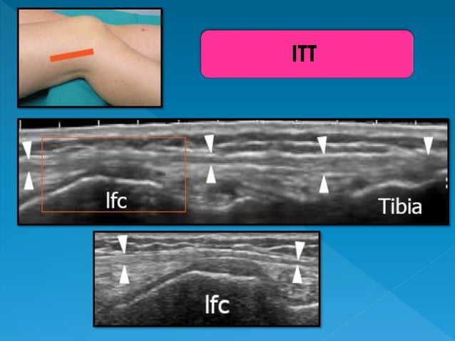 Msk US LL anatomy & technique pdf | PPT