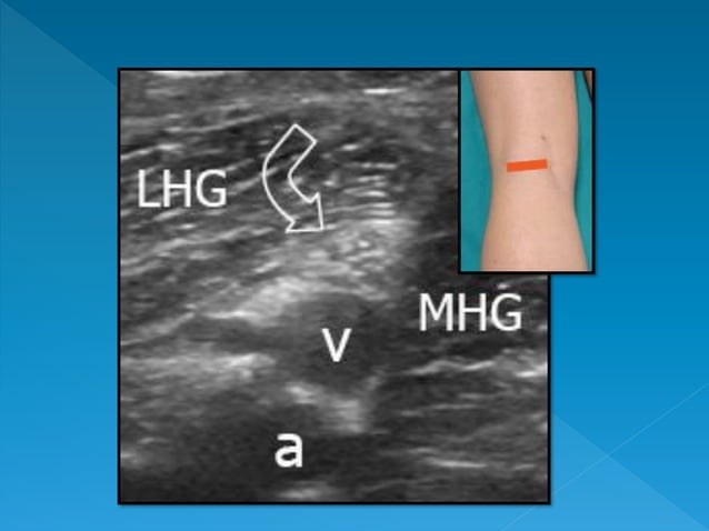Msk US LL anatomy & technique pdf | PPT