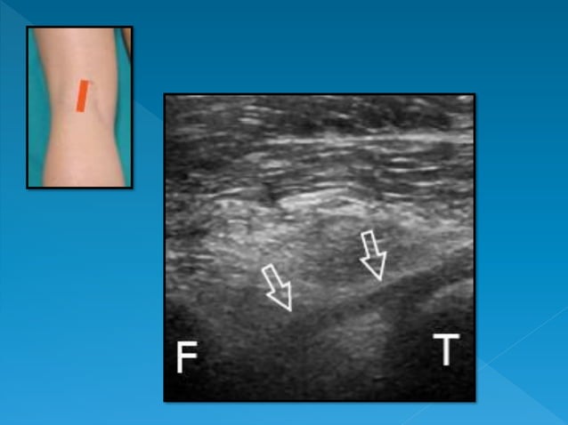 Msk US LL anatomy & technique pdf | PPT