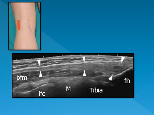 Msk US LL anatomy & technique pdf | PPT