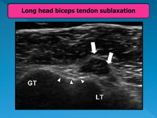 MSK US UL pathology pdf | PPT