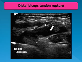 MSK US UL pathology pdf | PPT
