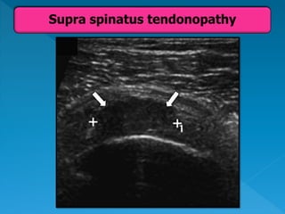 MSK US UL pathology pdf | PPT