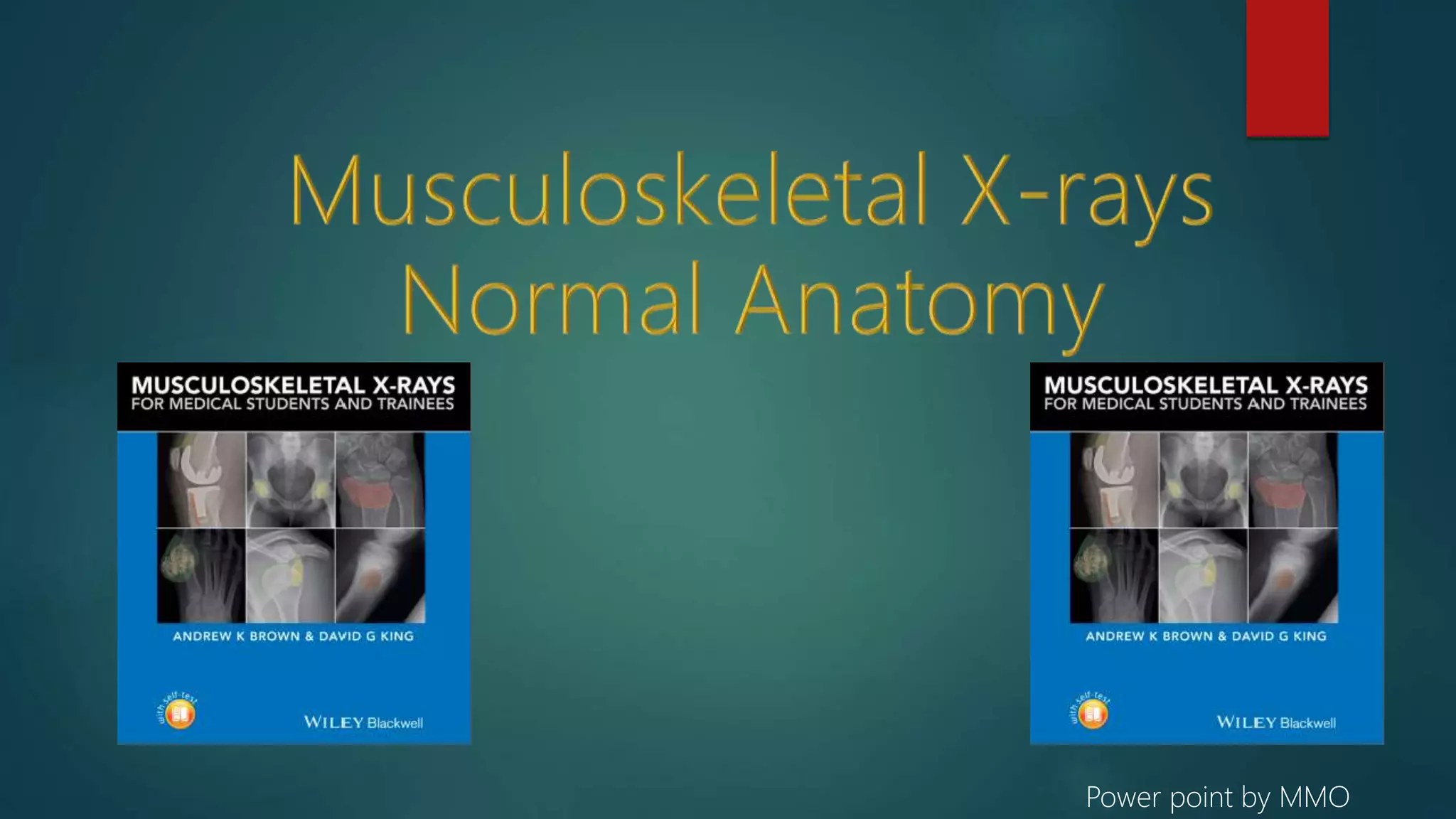 Musculoskeletal X Ray at Karen Acuff blog