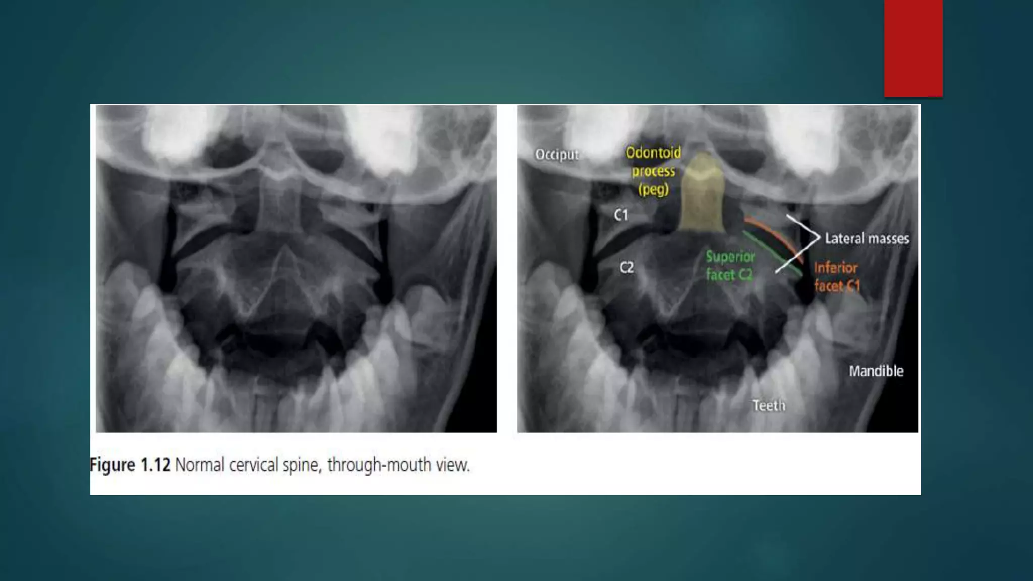 Msk x ray normal anatomy | PPTX