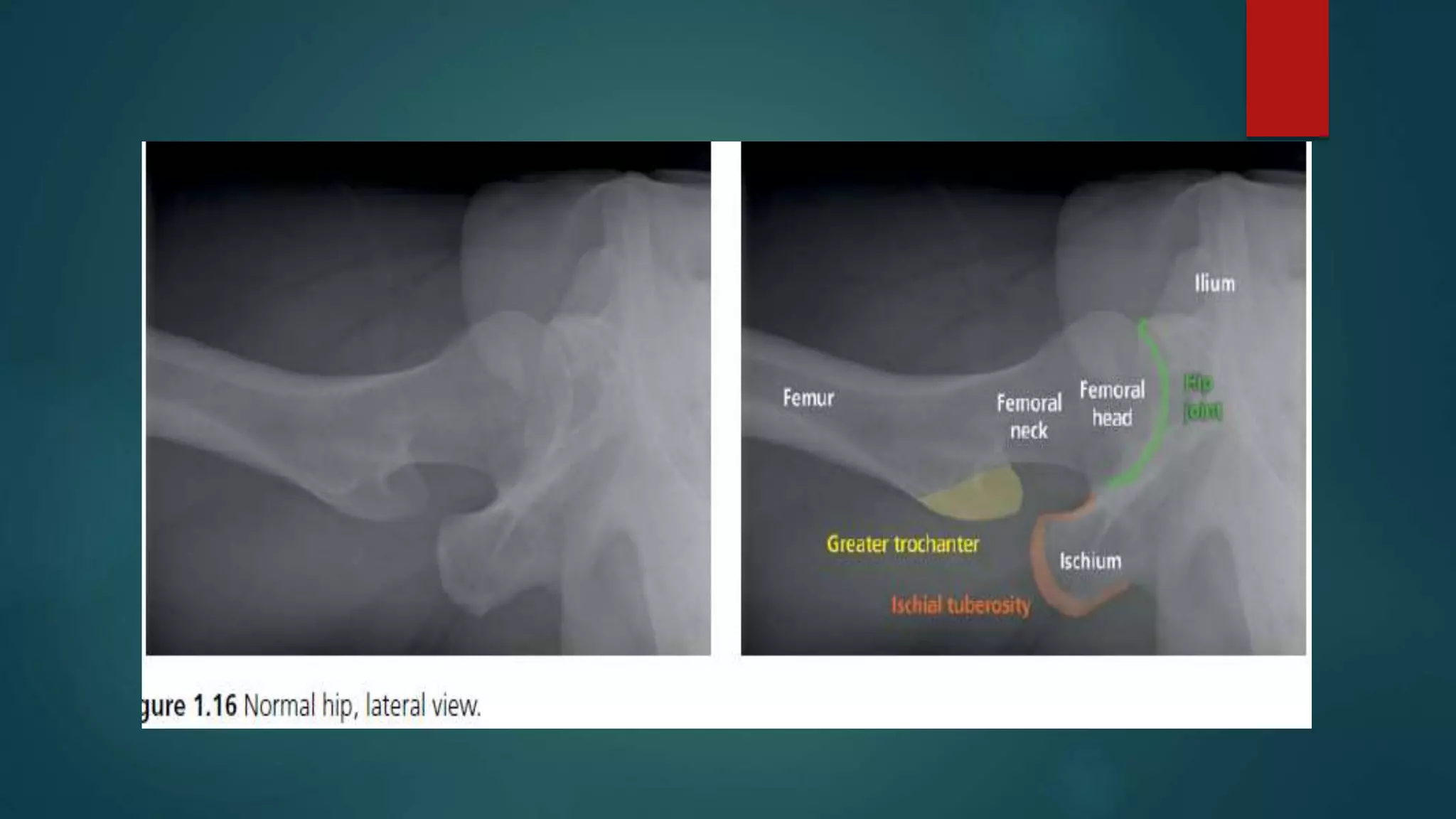 Msk x ray normal anatomy | PPTX