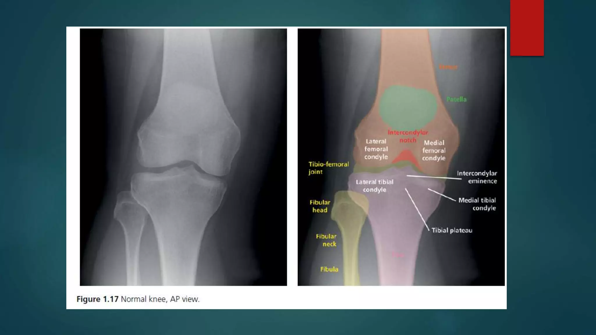 Msk x ray normal anatomy | PPTX