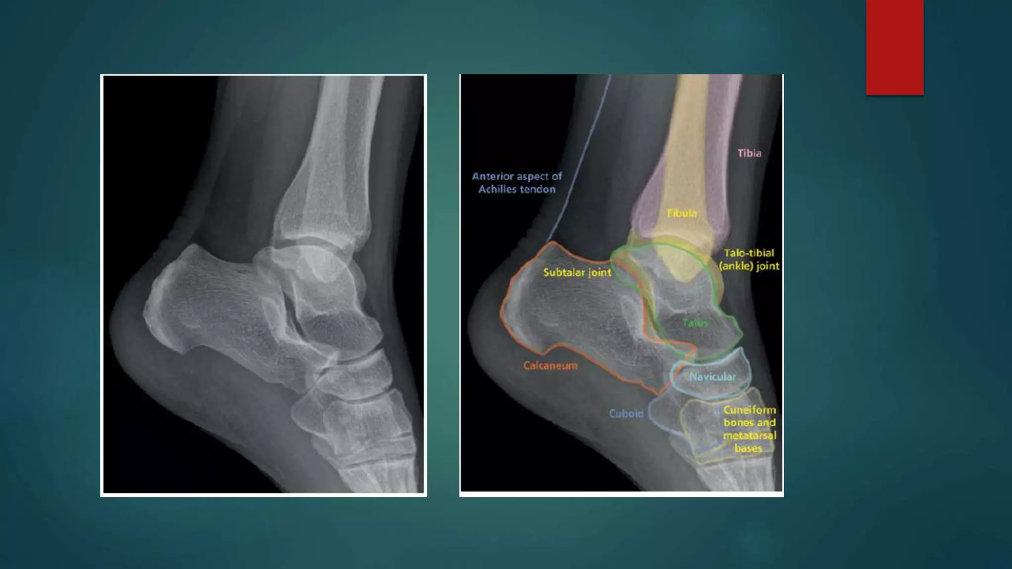 Msk x ray normal anatomy | PPTX