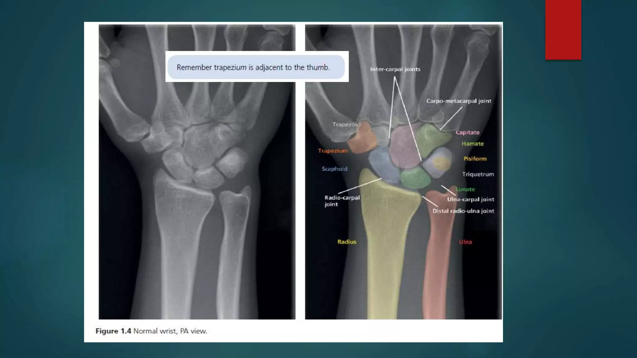 Msk x ray normal anatomy | PPTX