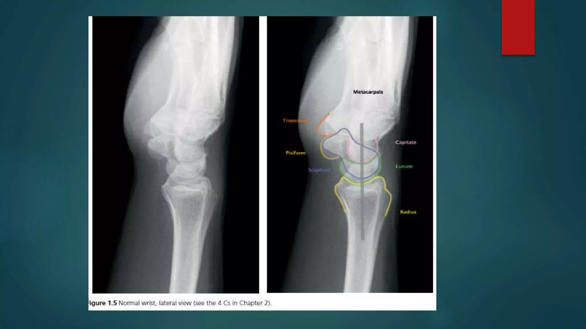 Msk x ray normal anatomy | PPTX