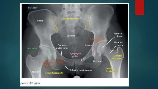 Msk x ray normal anatomy | PPTX