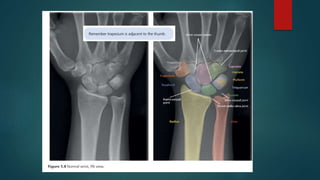 Msk x ray normal anatomy | PPTX