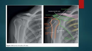 Msk x ray normal anatomy | PPTX