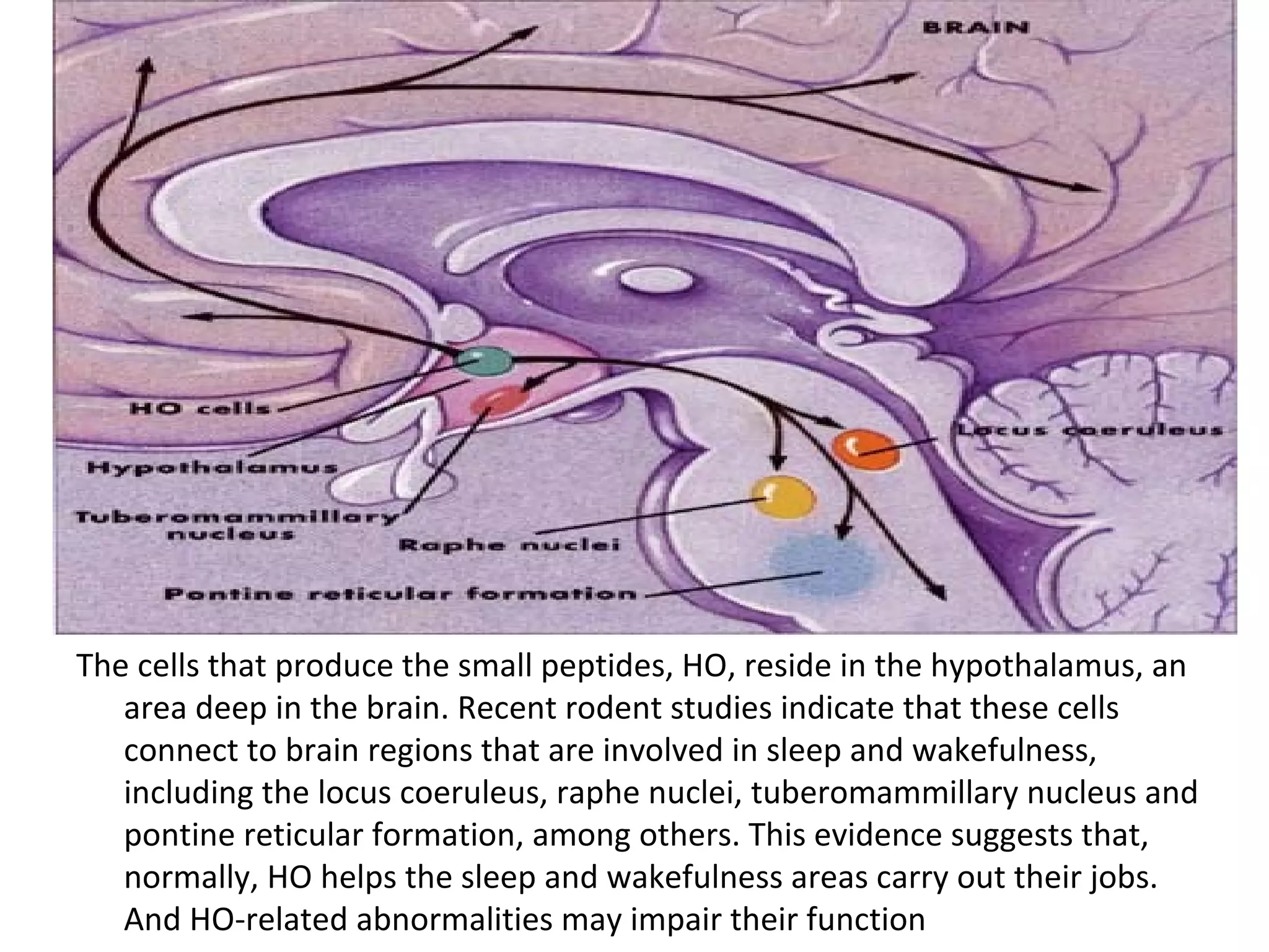 Multiple sleep latency Test (MSLT) and Maintenance of Wakefulness Test ...