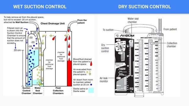 Medical surgical nursing topic ,intercostal drainage or water seal ...