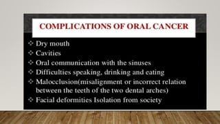 Oral Cancer | PPT