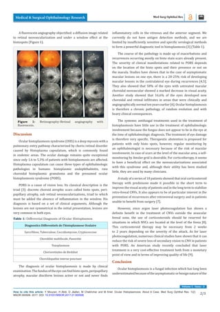 Ocular Histoplasmosis: About A Case | Crimson Publishers | PDF