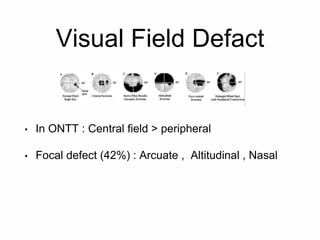 Optic Neuritis and OCT in Multiple Sclerosis | PPTX