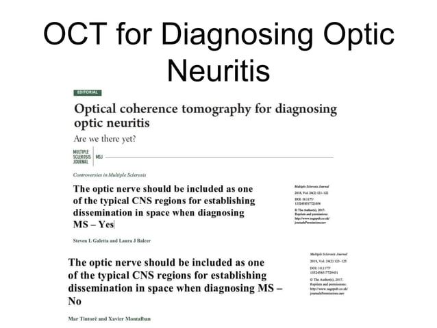 Update on Optic Neuritis and the role of OCT In Multiple Sclerosis | PPTX