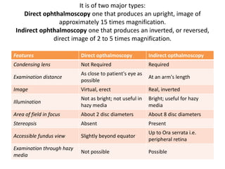 ppt on direct opthalmoscopy | PPTX