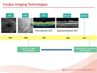 Pachychoroid spectrum diseases | PPTX